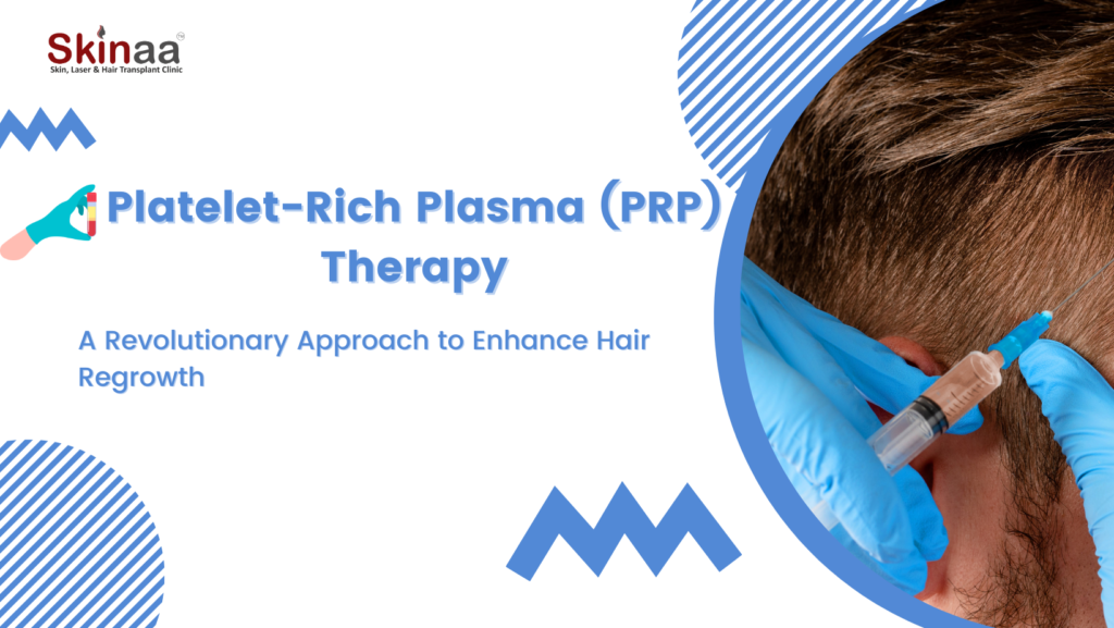 Platelet-Rich Plasma (PRP) Therapy: A Revolutionary Approach to Enhance Hair Regrowth - Skinaa ...